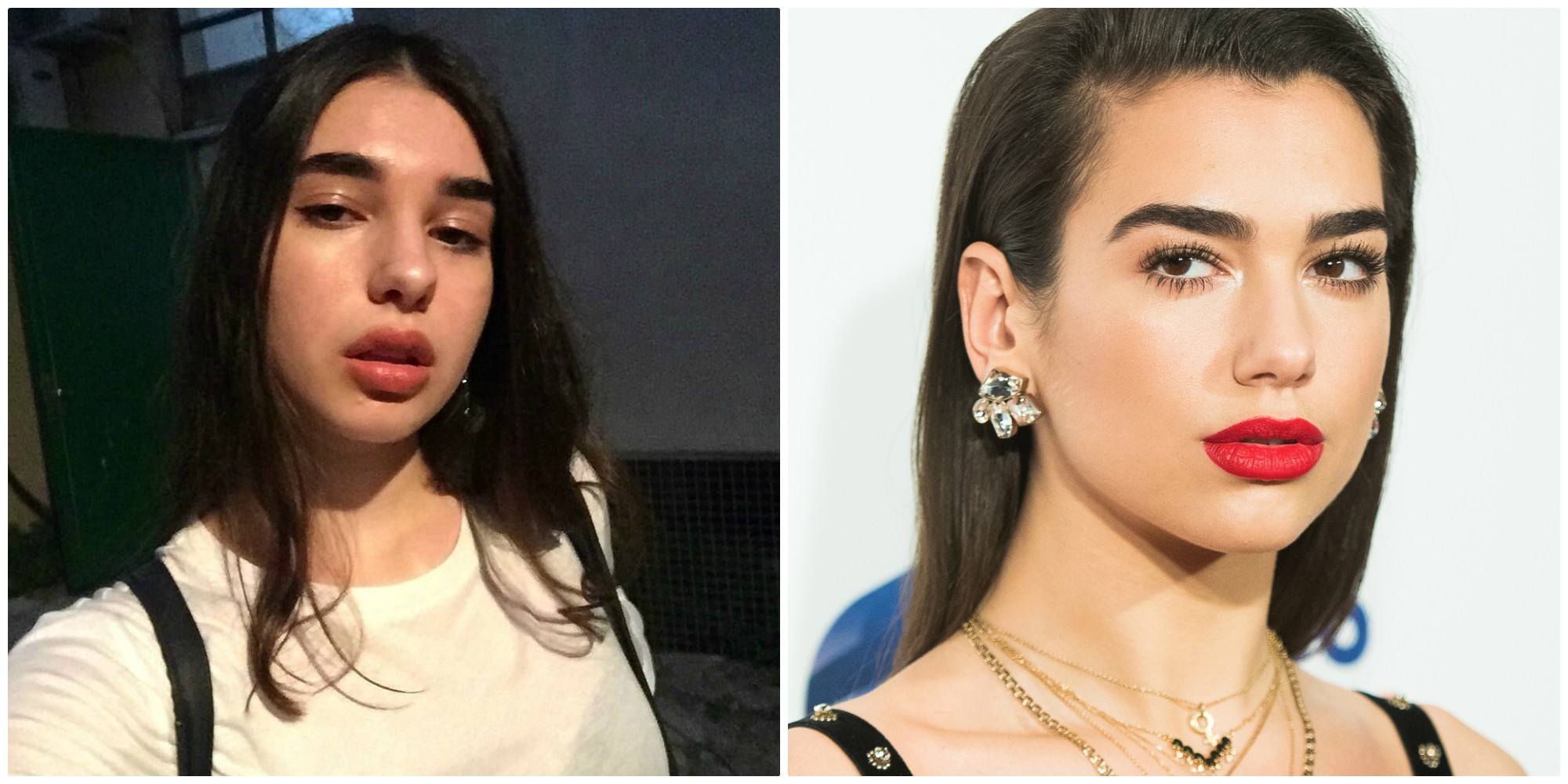 Si dy pika uji, njihuni me sozinë e Dua Lipës – Abc News